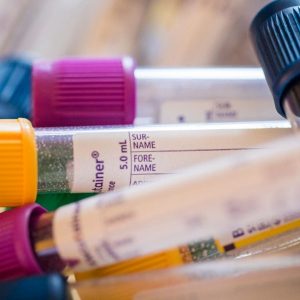 Reading Your Female Hormone Profile Results - Marion Gluck